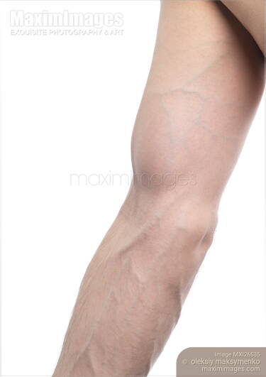 Photo of Closeup of arm and elbow | Stock Image MXI26535